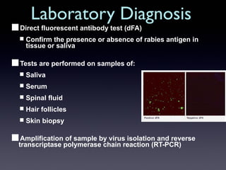 Rabies & Polio | PPT