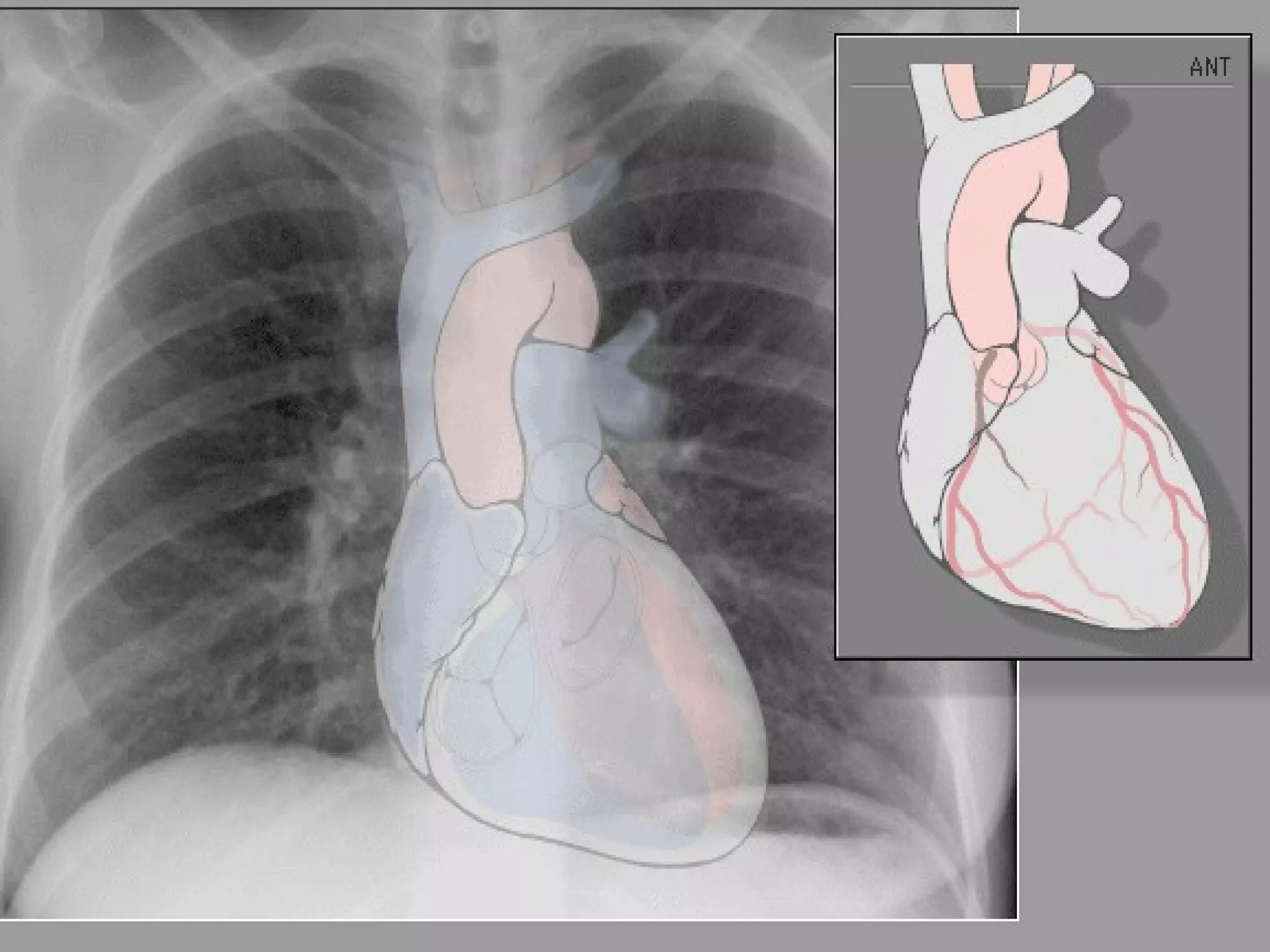 5 radiologia serie cardiaca