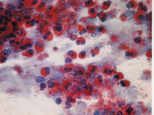 Air Pollution and its Effects on Human Health | PPTX | Lung and ...