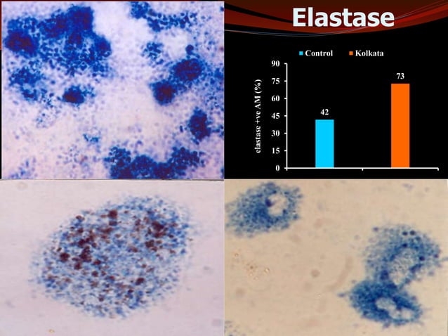 Air Pollution and its Effects on Human Health | PPTX | Lung and ...
