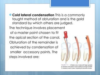 5 root canal filling materials | PPT