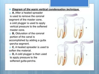 5 Root canal filling materials.ppt