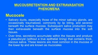 Lecture 5 Diagnosis and management of salivary gland disorders Part 2 ...