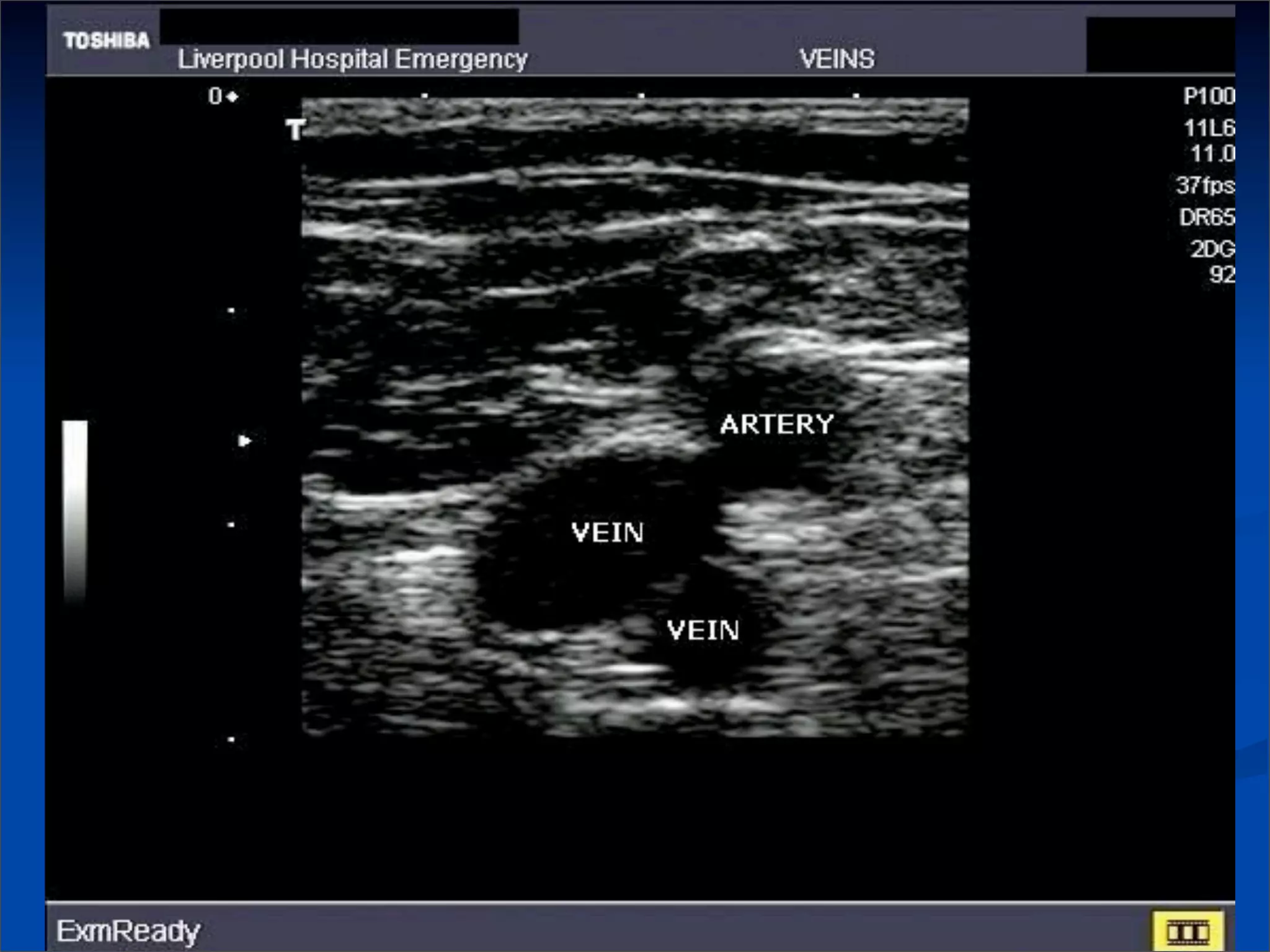 5 scanning for dvt | PDF