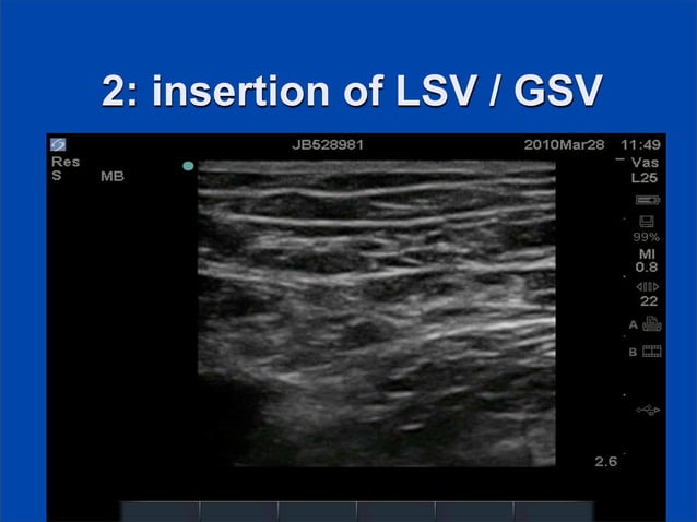 5 scanning for dvt | PDF