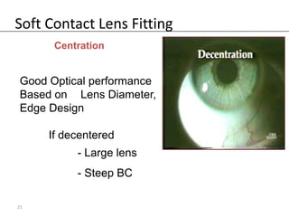 Soft Contact Lens Fitting | PPTX | Eye and Vision Conditions | Diseases ...