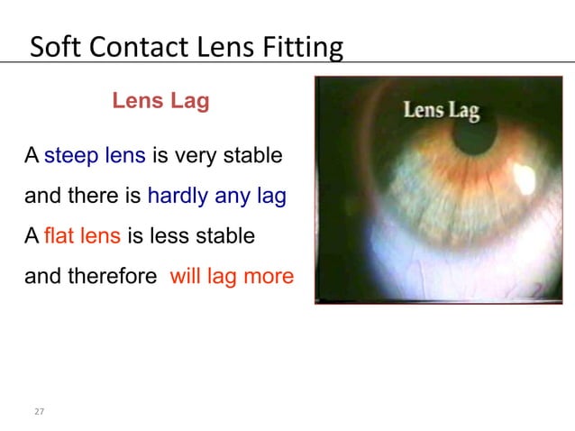 Soft Contact Lens Fitting