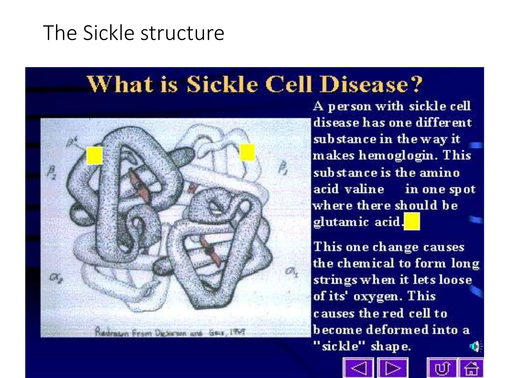 5Sickle Cell Disease-hematology disease .ppt