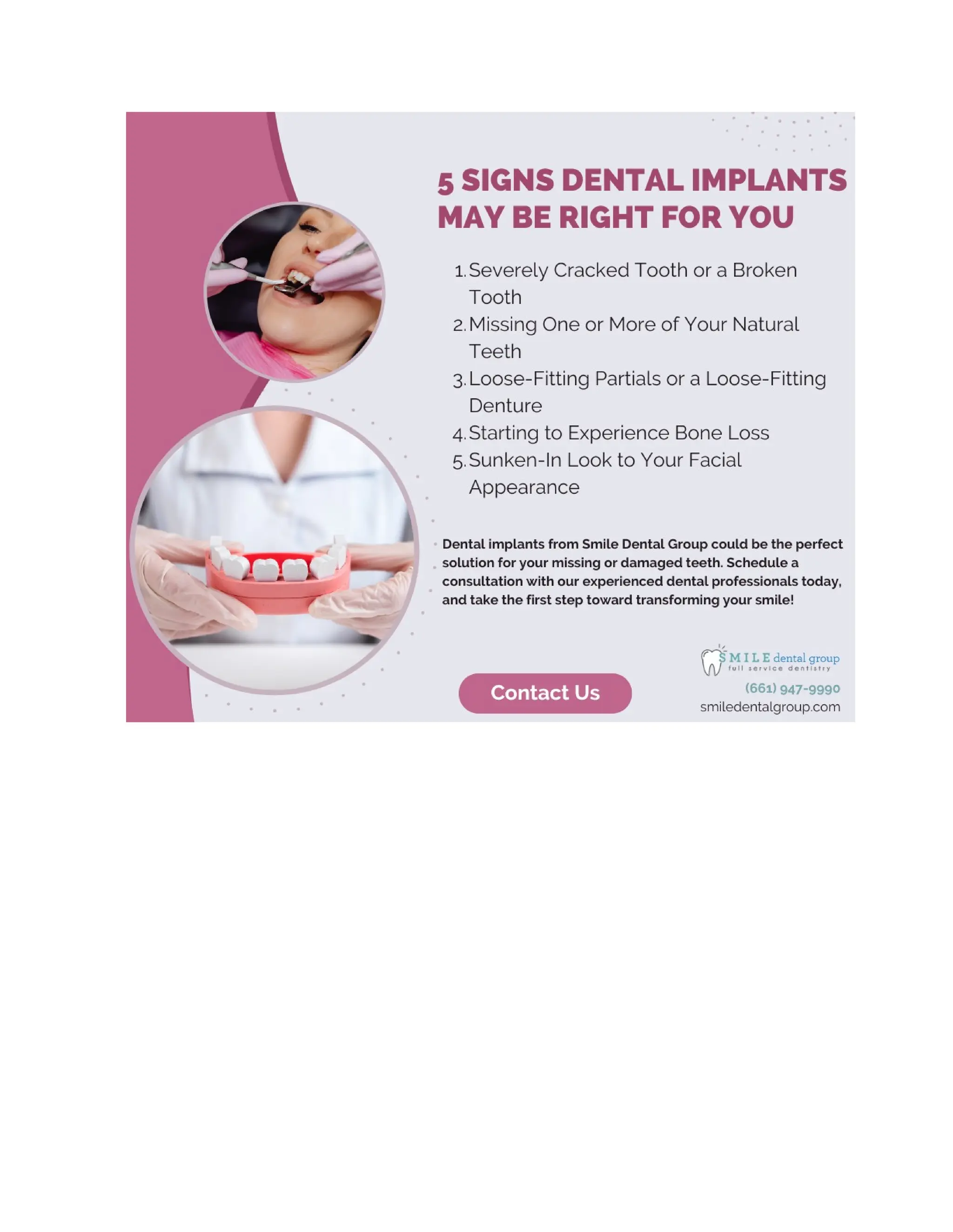 5 Signs Dental Implants May Be Right For You | DOCX