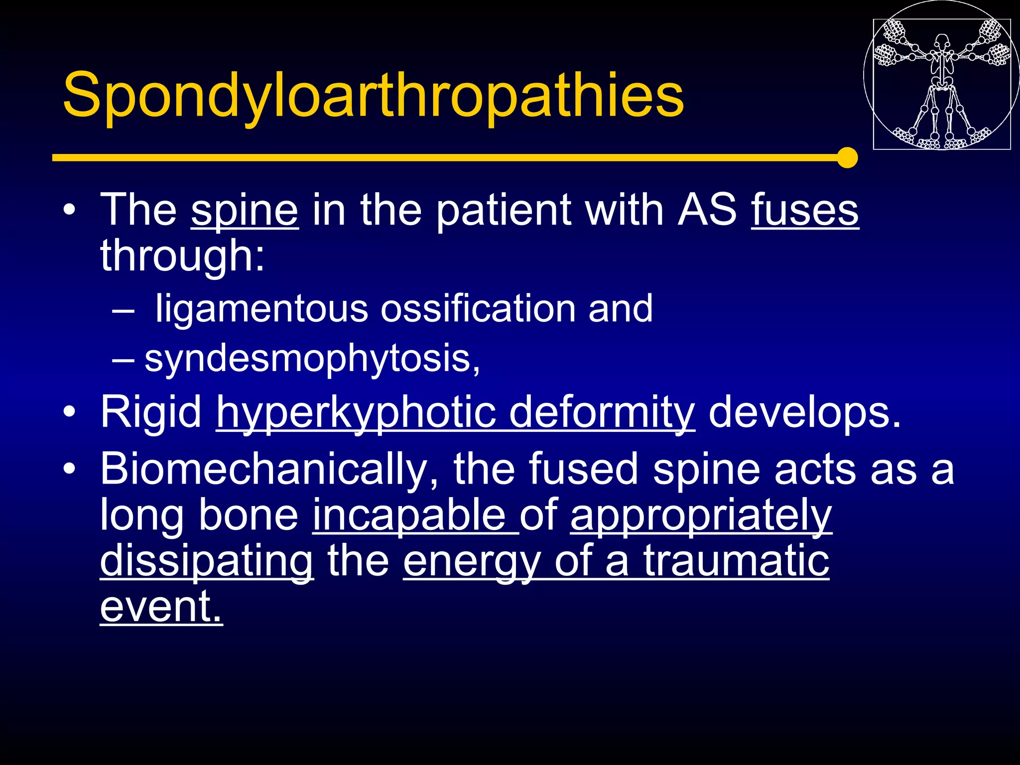 5spondyloarthropaties Seronegative Arthritis | PPT