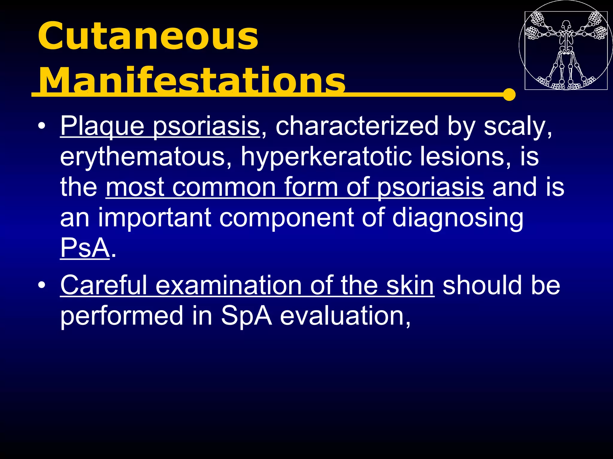 5spondyloarthropaties Seronegative Arthritis | PPT