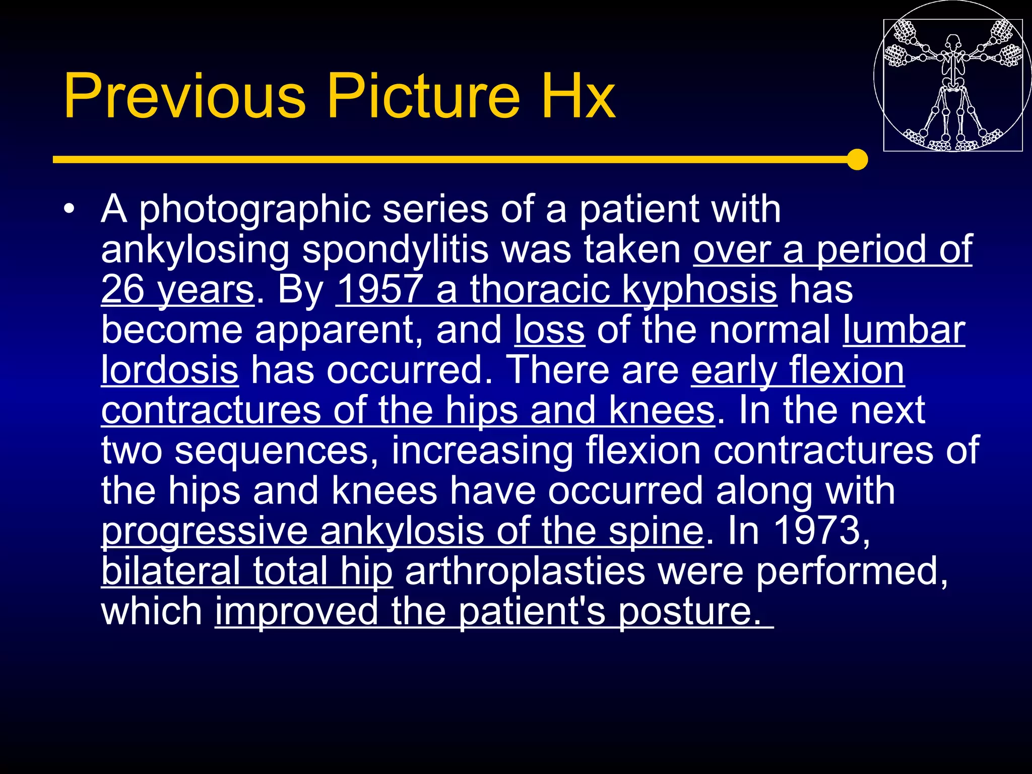 5spondyloarthropaties Seronegative Arthritis | PPT
