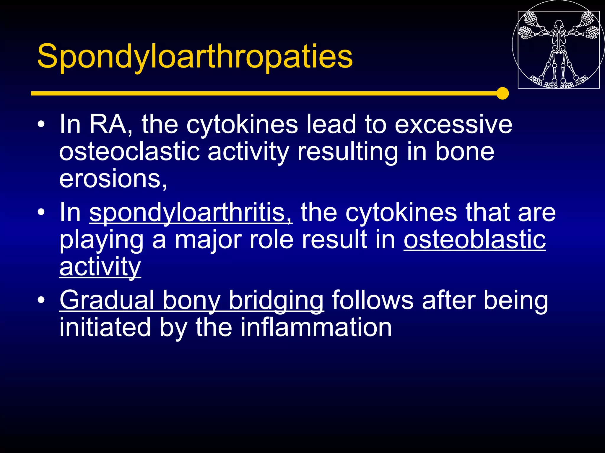 5spondyloarthropaties Seronegative Arthritis | PPT