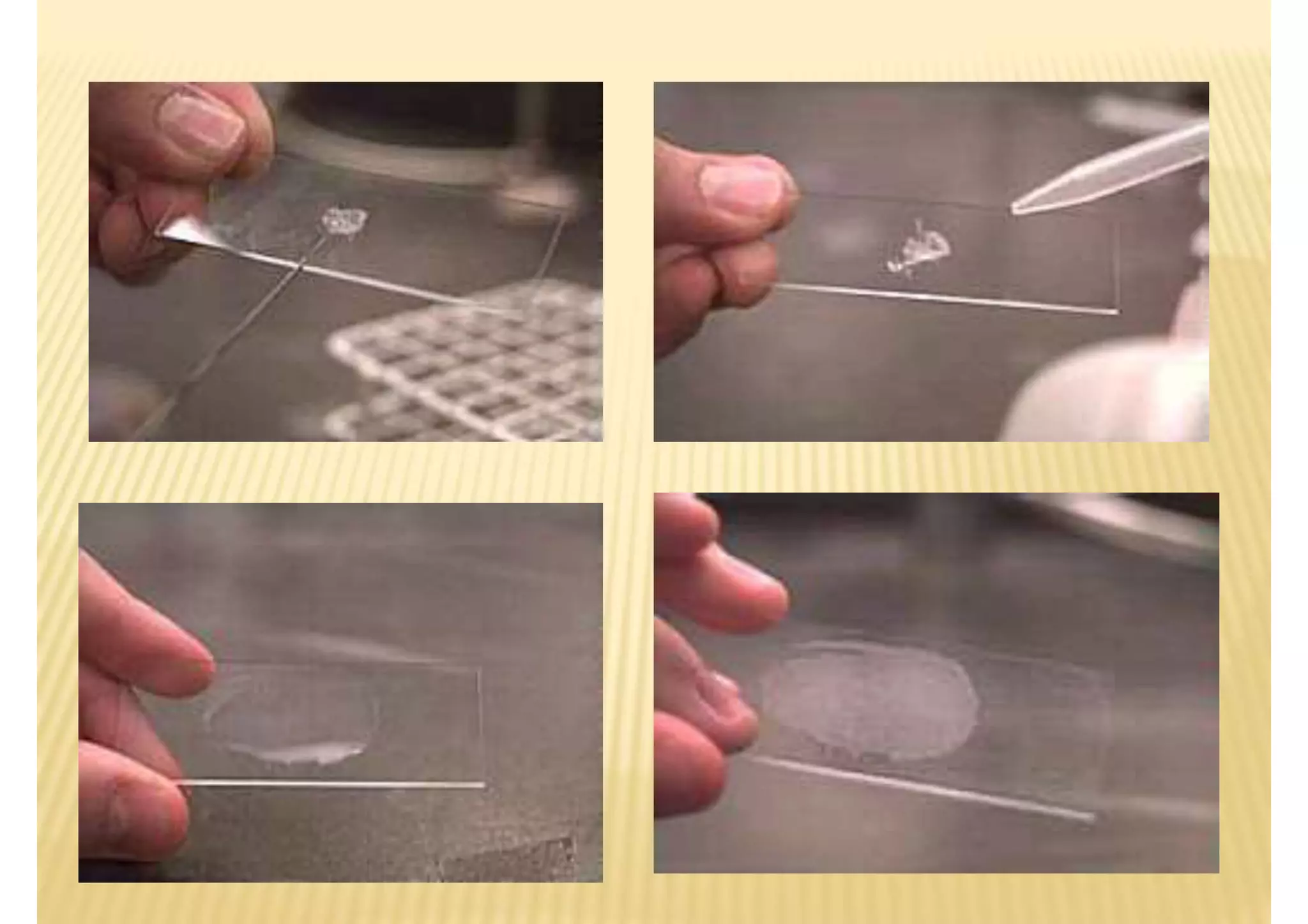 5. Staining techniques (Microbiology) | PDF