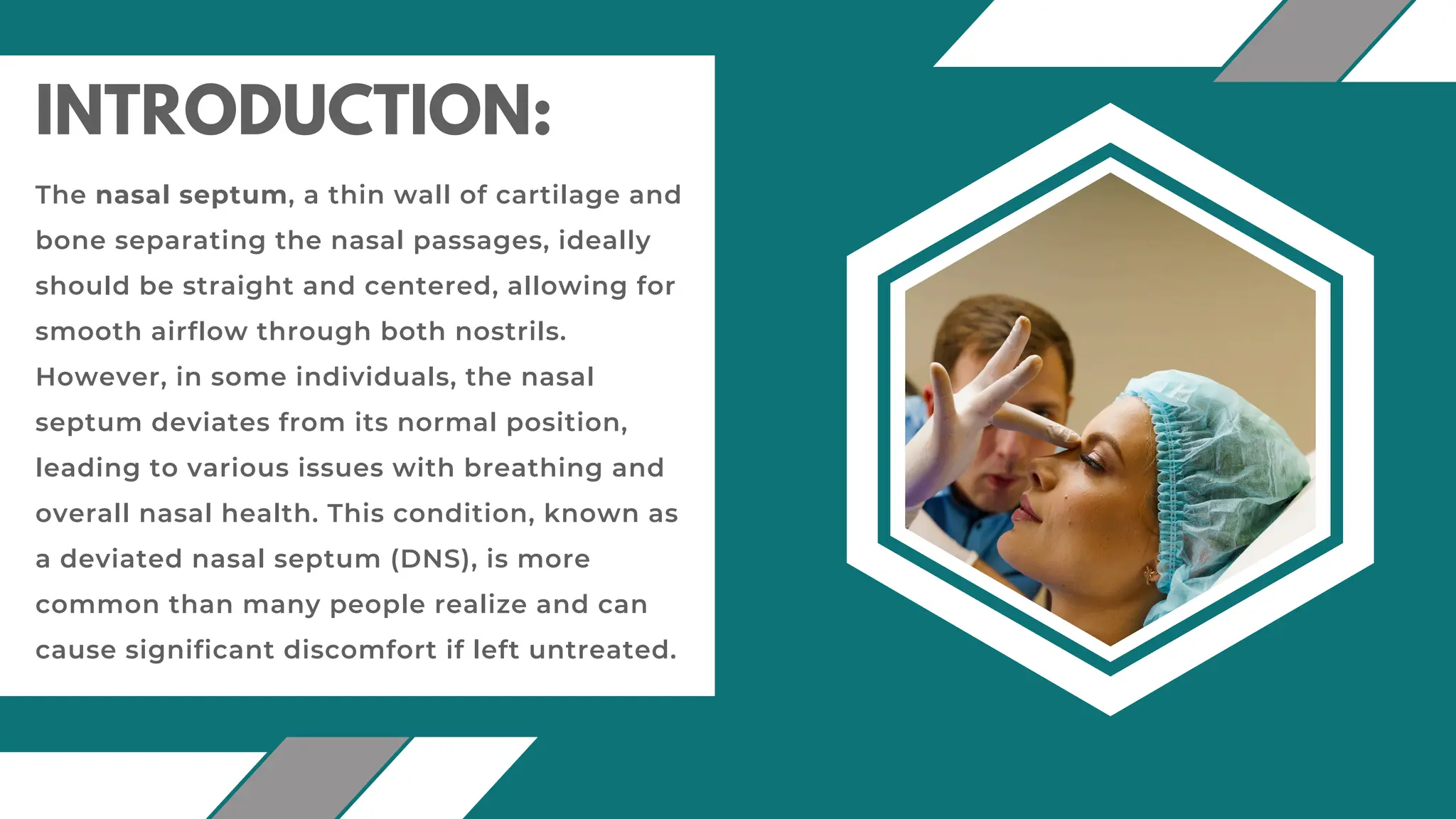5 Symptoms Of Deviated Nasal Septum. | PDF