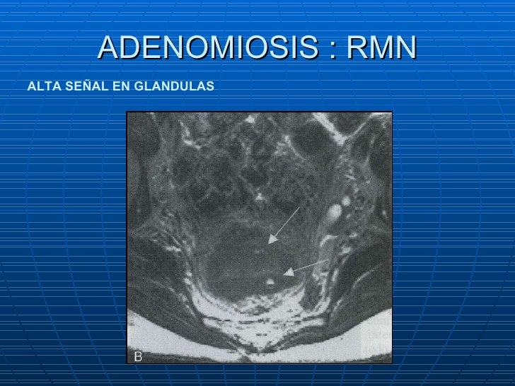 RADIOLOGIA - 5TA CLASE