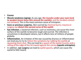 Ophthalmology | PPTX