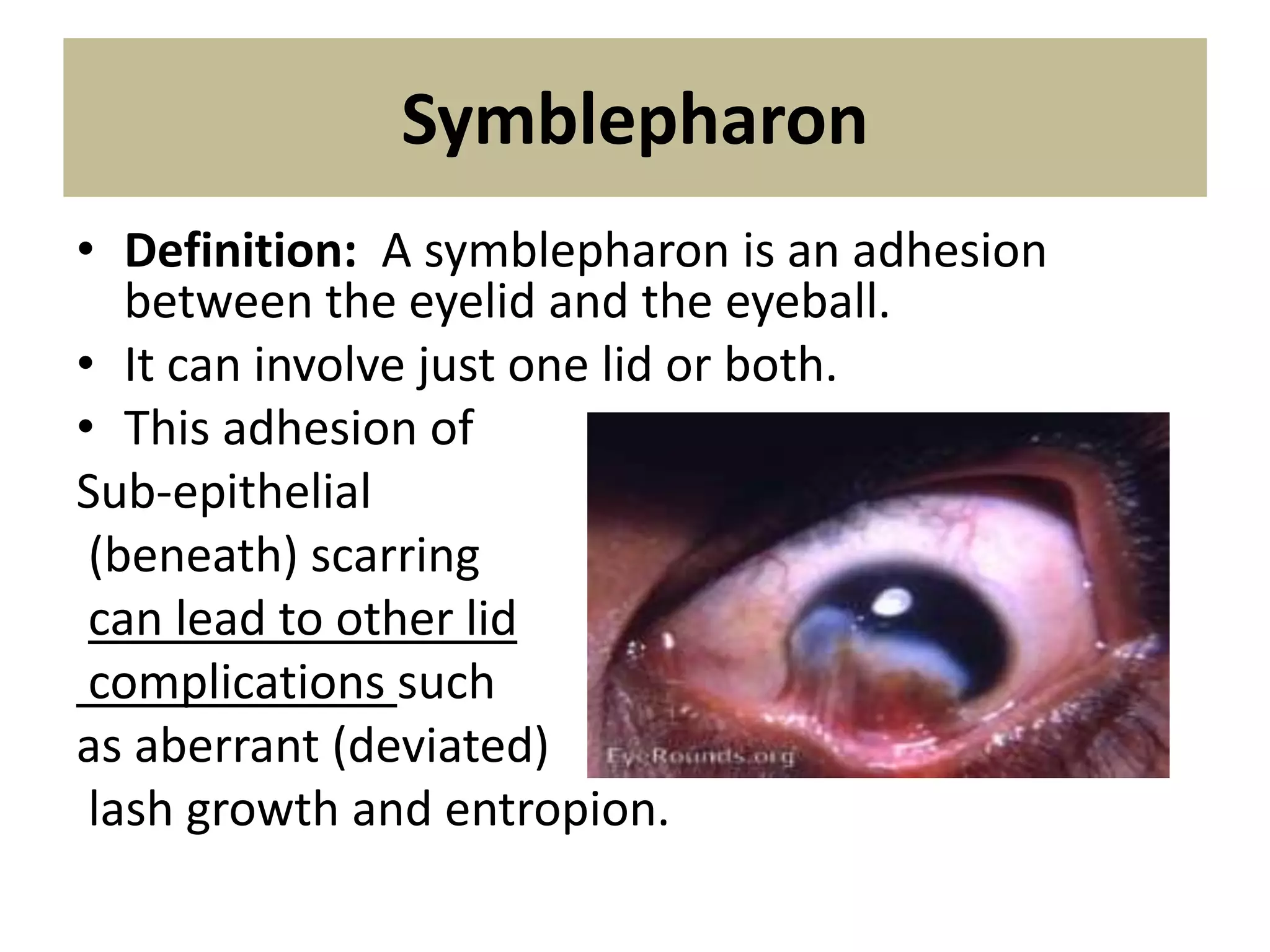 Ophthalmology | PPTX