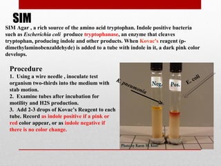 Sim Test Microbiology