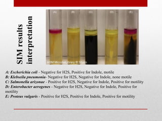 Sim Test Microbiology
