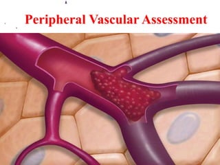 5th lecture - assessment of vascular system - master- lamia-1 (1).ppt