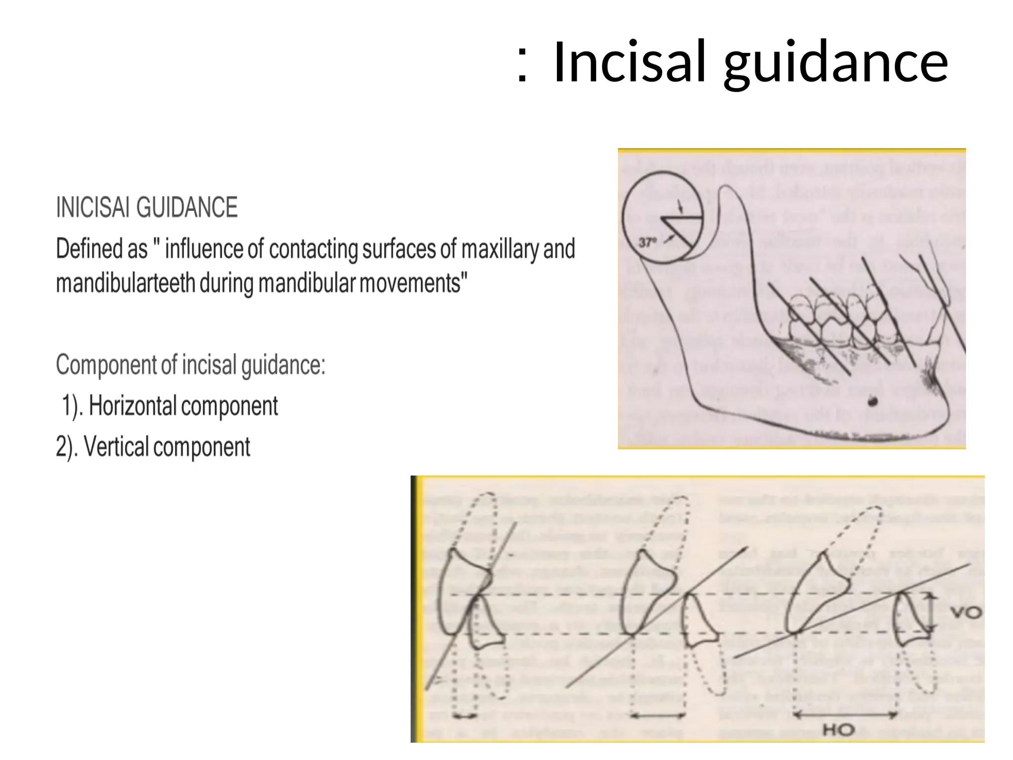 5th L mutually protected occlusion.pptx