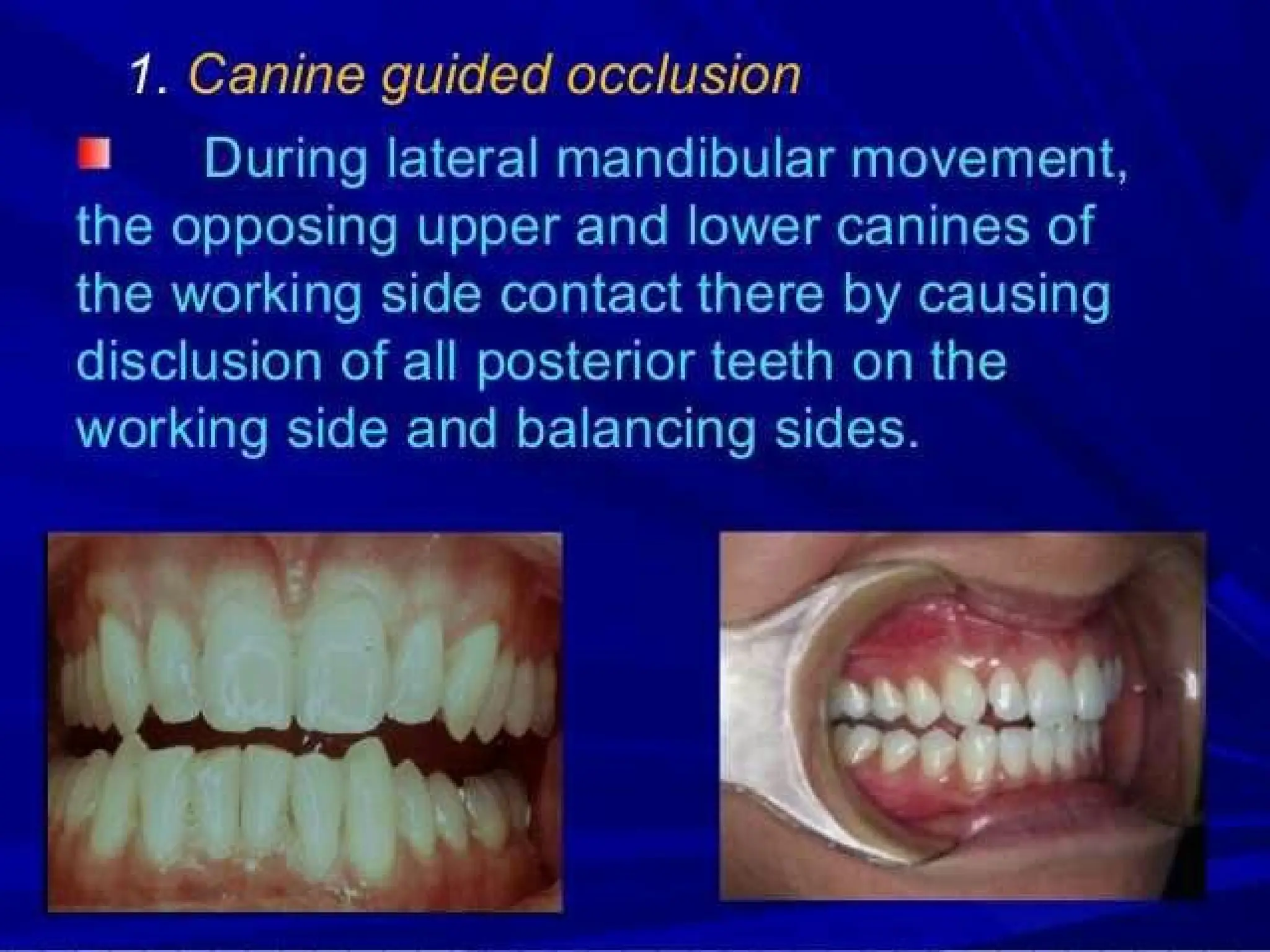 5th L mutually protected occlusion.pptx