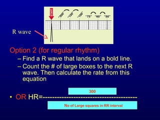 5th part ECG basics: supraventricular arrhythmias Dr Salah Mabrouk ...