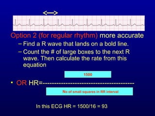 5th part ECG basics: supraventricular arrhythmias Dr Salah Mabrouk ...