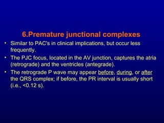 5th part ECG basics: supraventricular arrhythmias Dr Salah Mabrouk ...