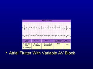 5th part ECG basics: supraventricular arrhythmias Dr Salah Mabrouk ...