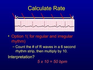 5th part ECG basics: supraventricular arrhythmias Dr Salah Mabrouk ...