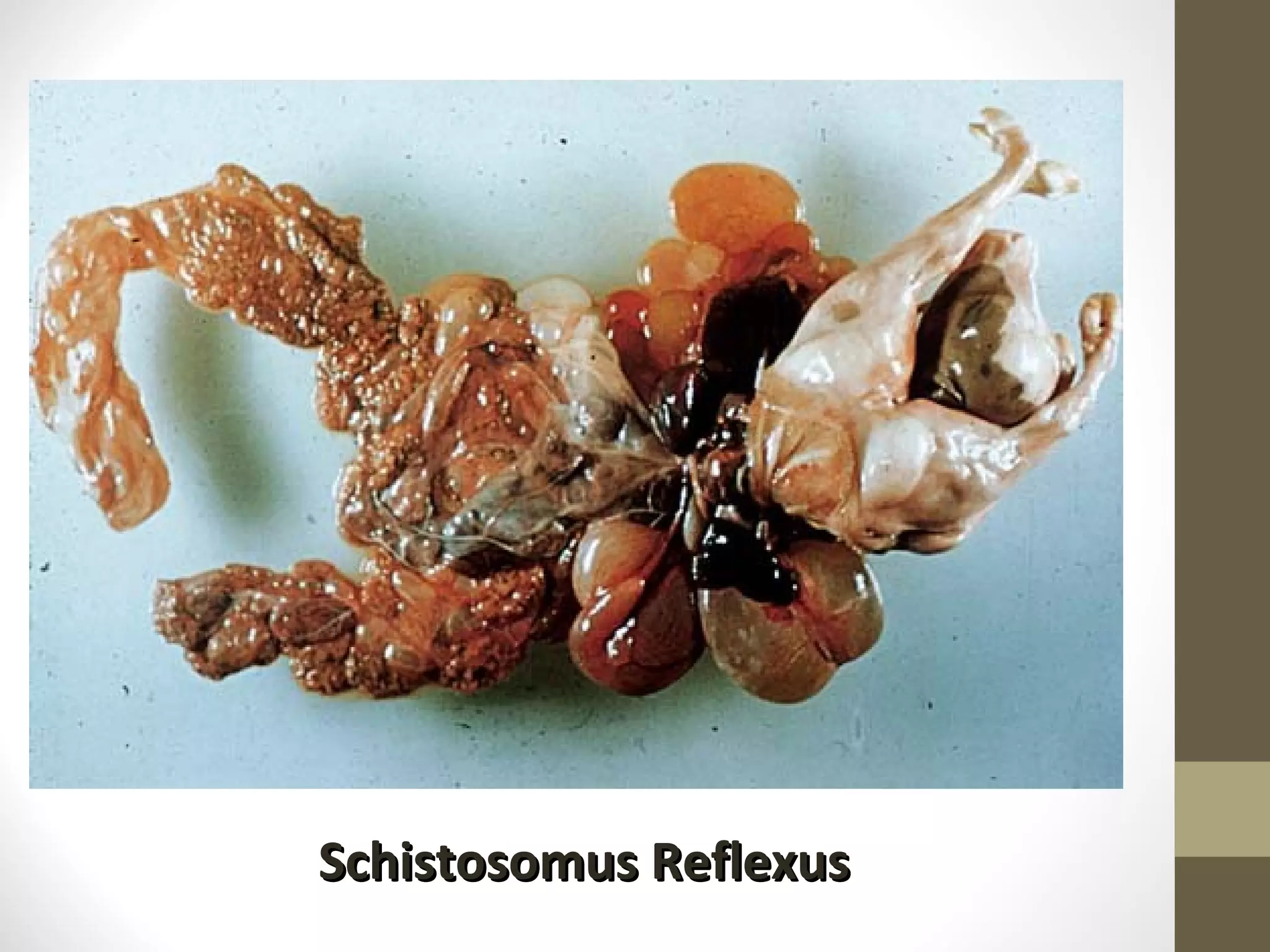 5th year practical revision 3 - fetal anomalies | PPT