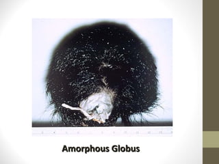 5th year practical revision 3 - fetal anomalies | PPT