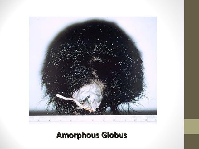 5th year practical revision 3 - fetal anomalies | PPT