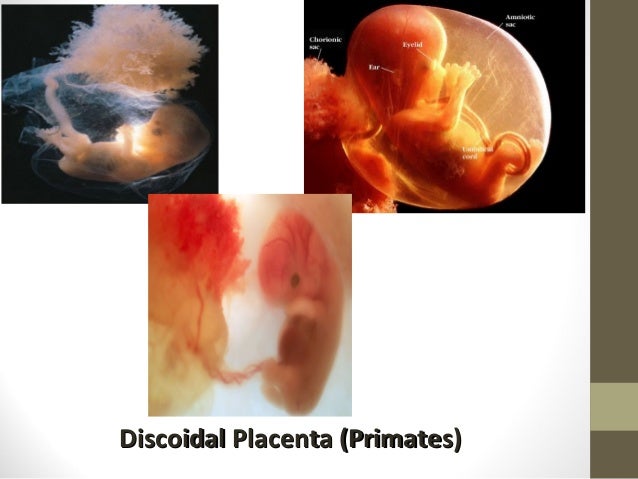 5th year practical revision 4 - placentation