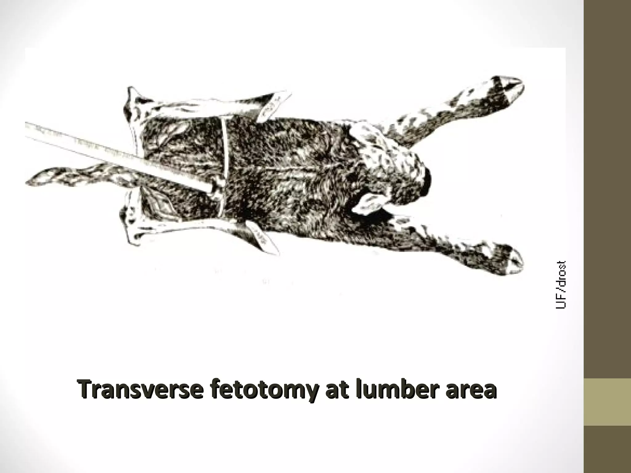 5th year practical revision 7 - fetotomy | PPT