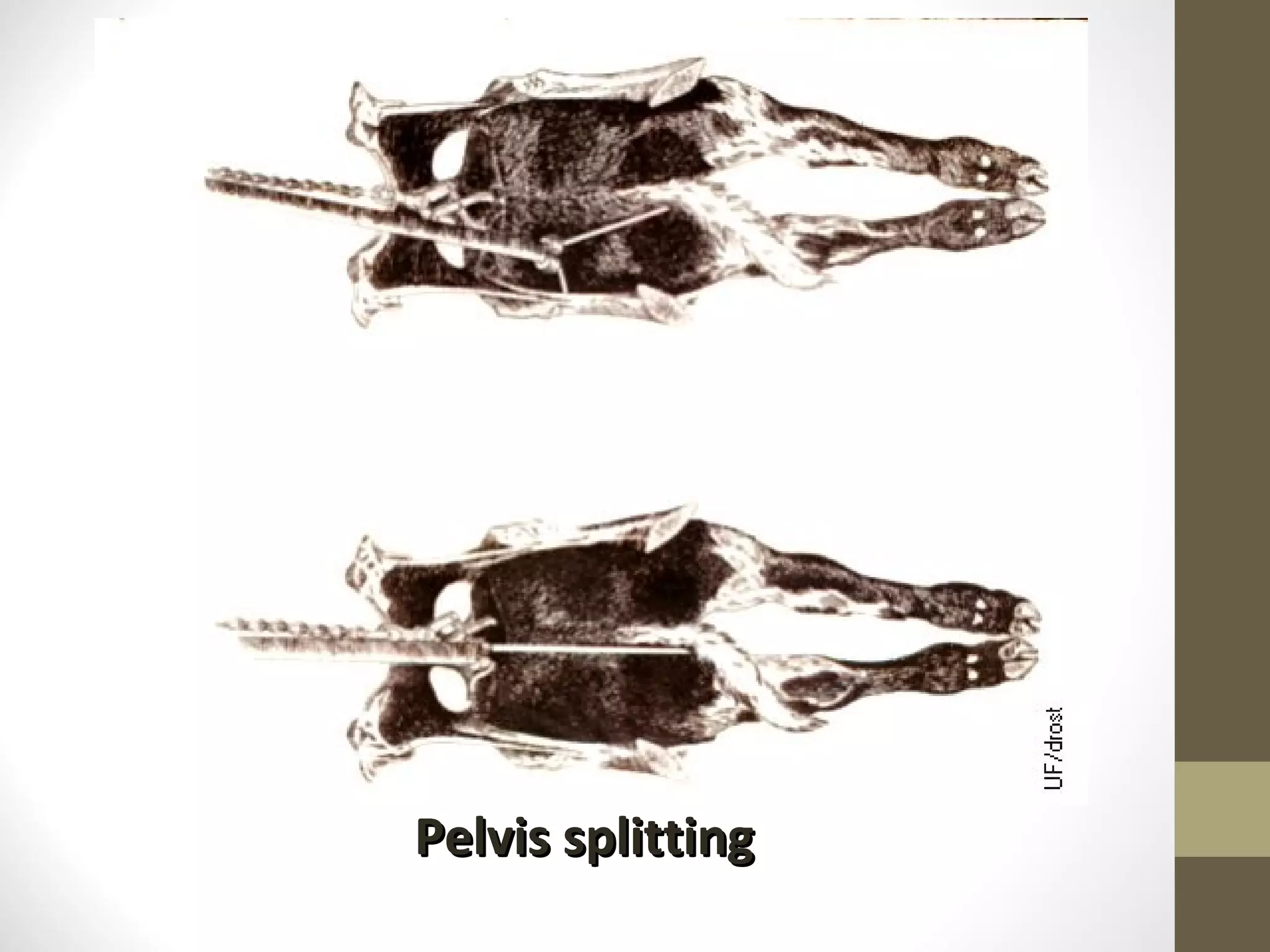 5th year practical revision 7 - fetotomy | PPT