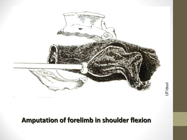 5th year practical revision 7 - fetotomy | PPT