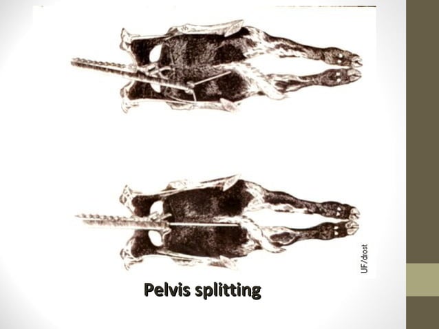 5th year practical revision 7 - fetotomy | PPT