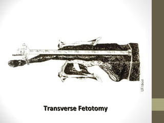 5th year practical revision 7 - fetotomy | PPT