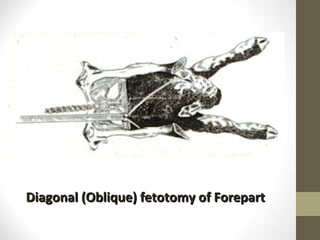 5th year practical revision 7 - fetotomy | PPT