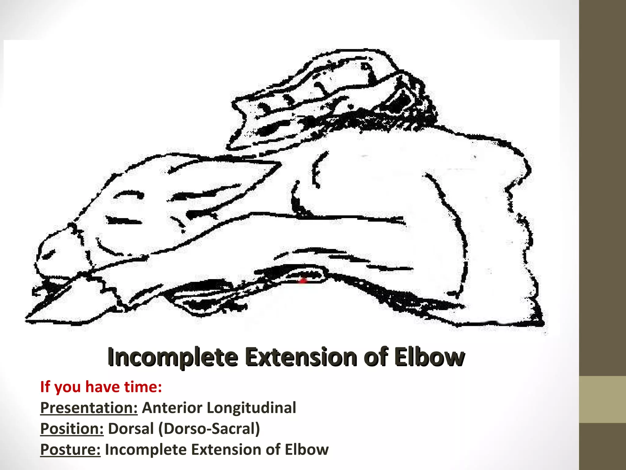 5th year practical revision fetal presentations | PPT