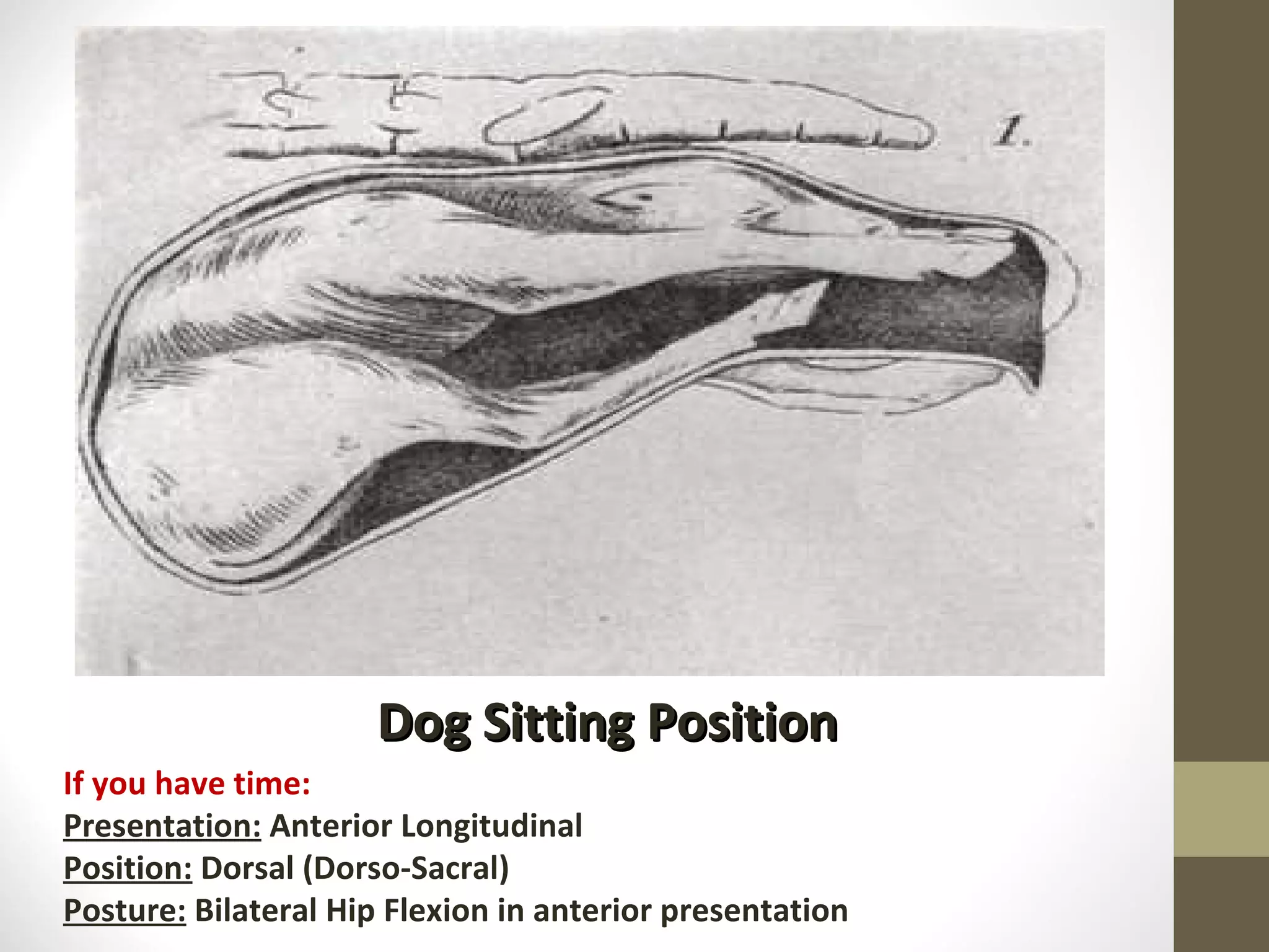 5th year practical revision fetal presentations | PPT