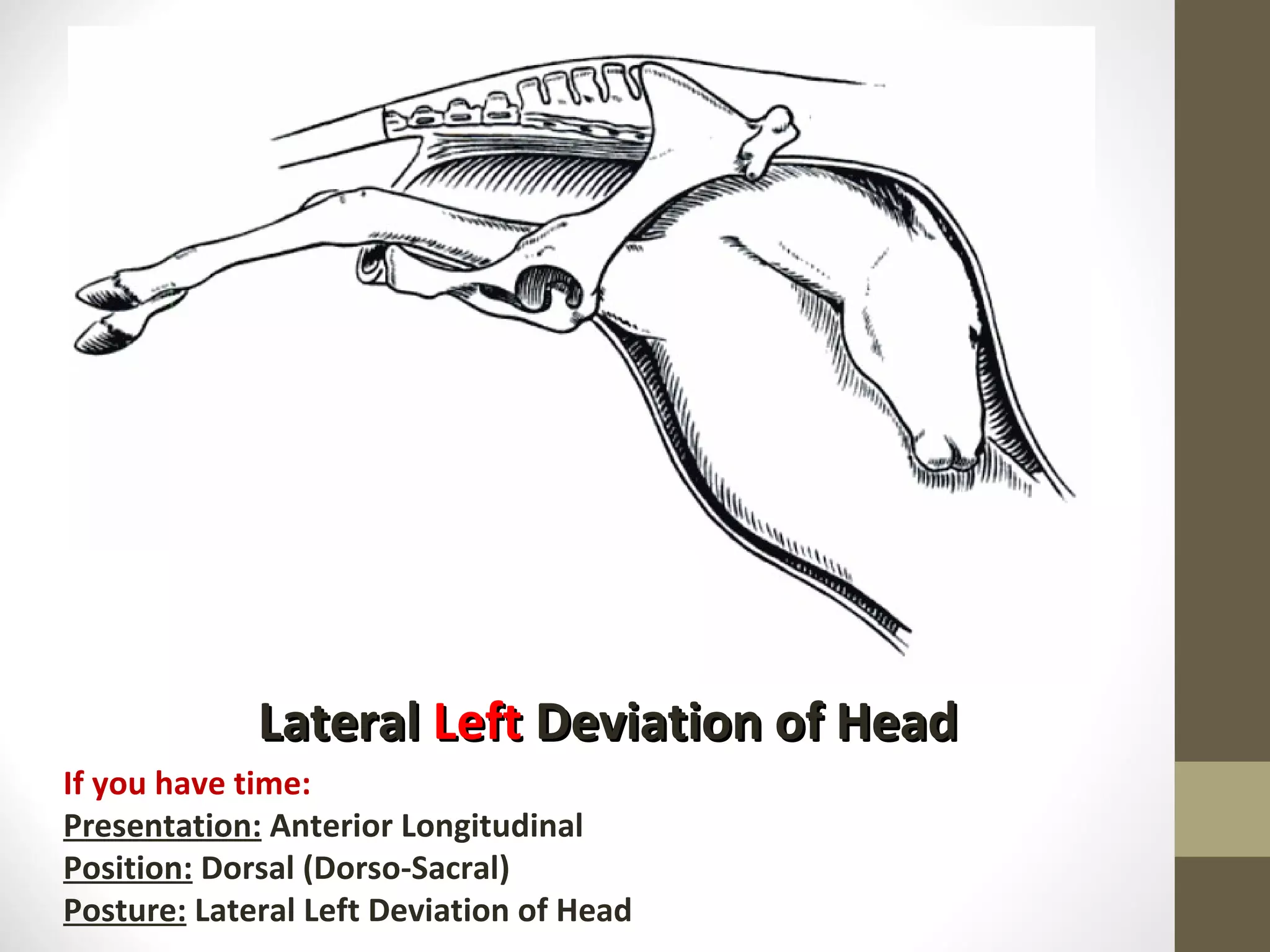 5th year practical revision fetal presentations | PPT