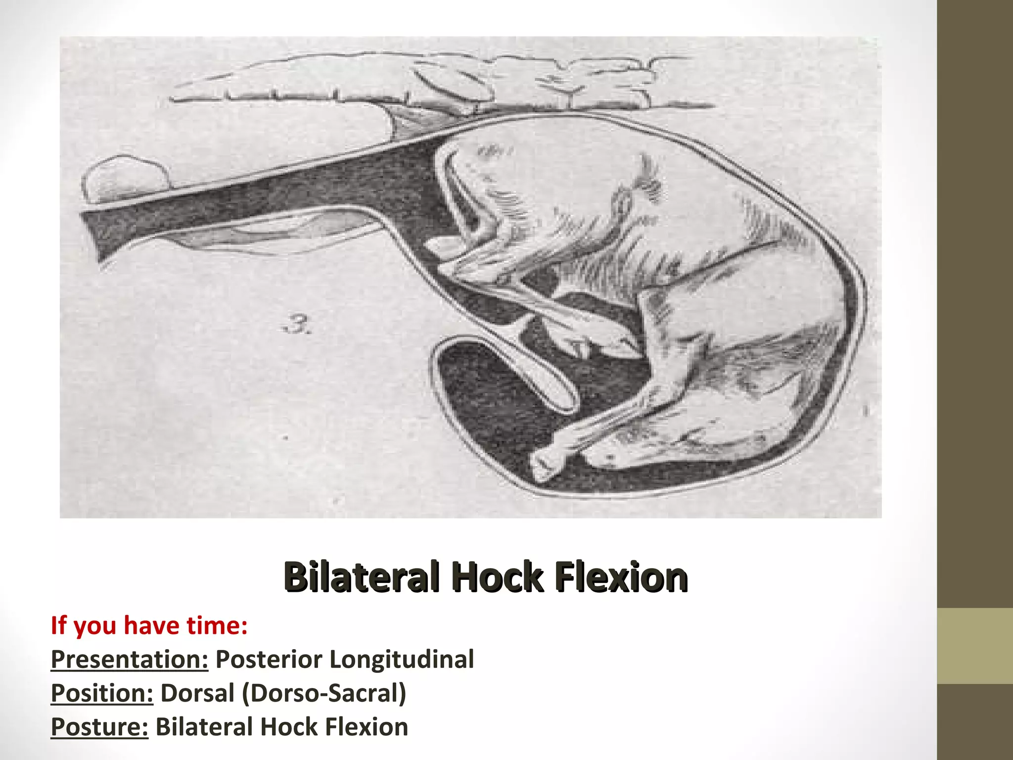 5th year practical revision fetal presentations | PPT