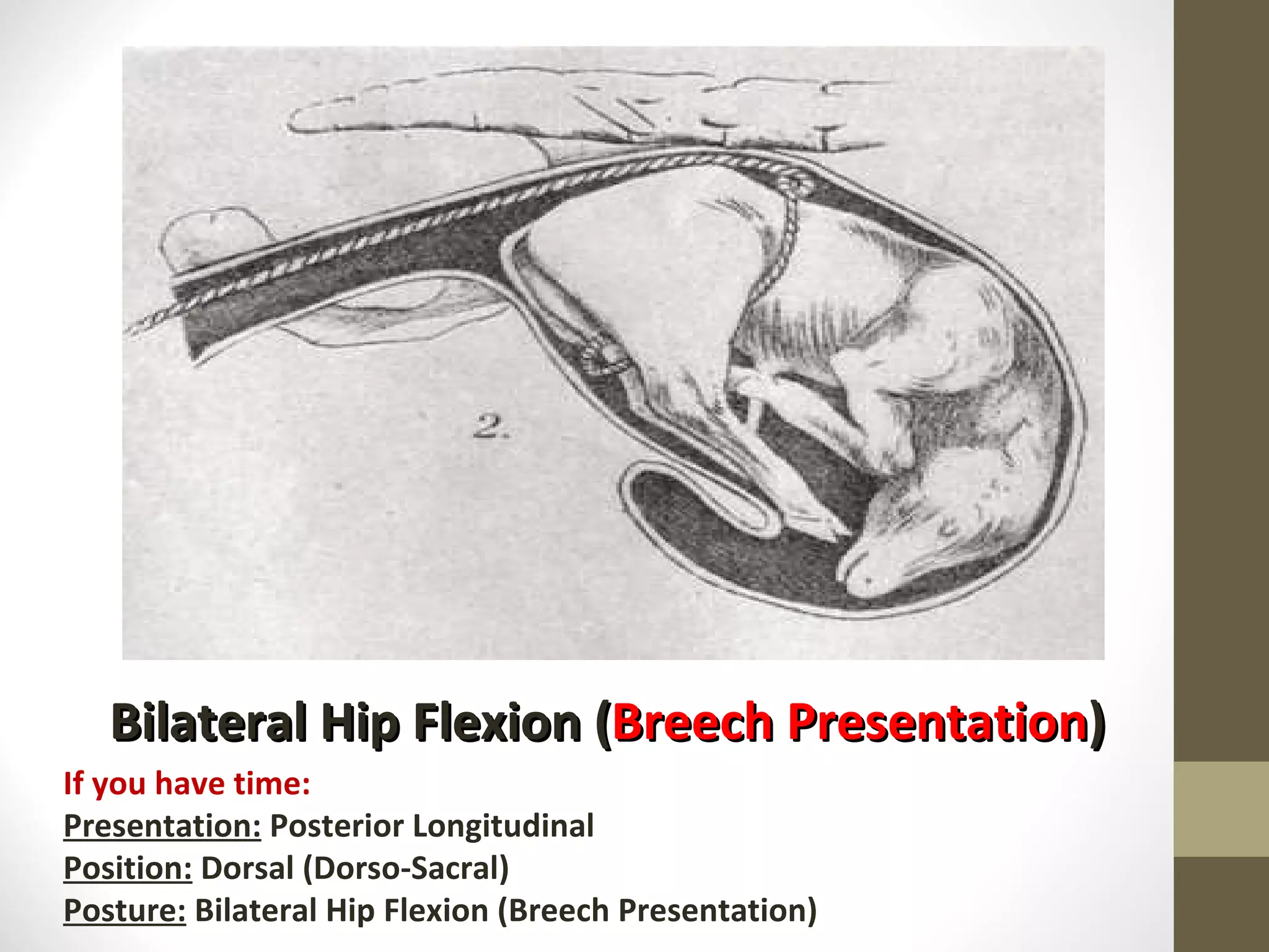 5th year practical revision fetal presentations | PPT