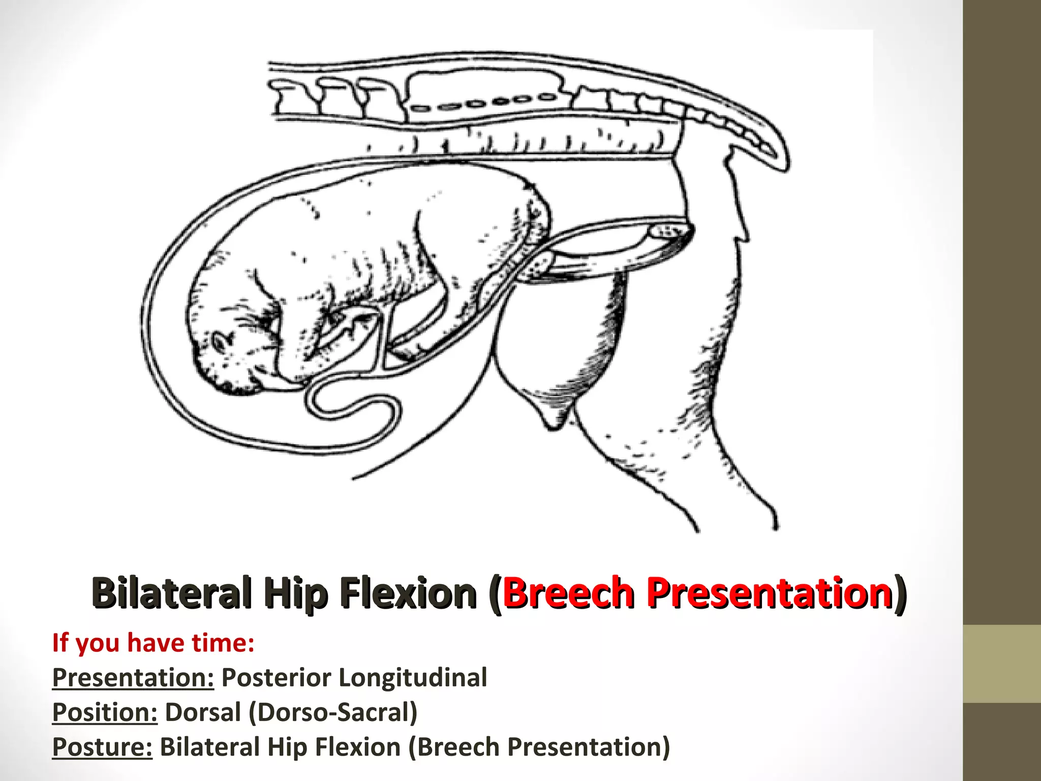 5th year practical revision fetal presentations | PPT