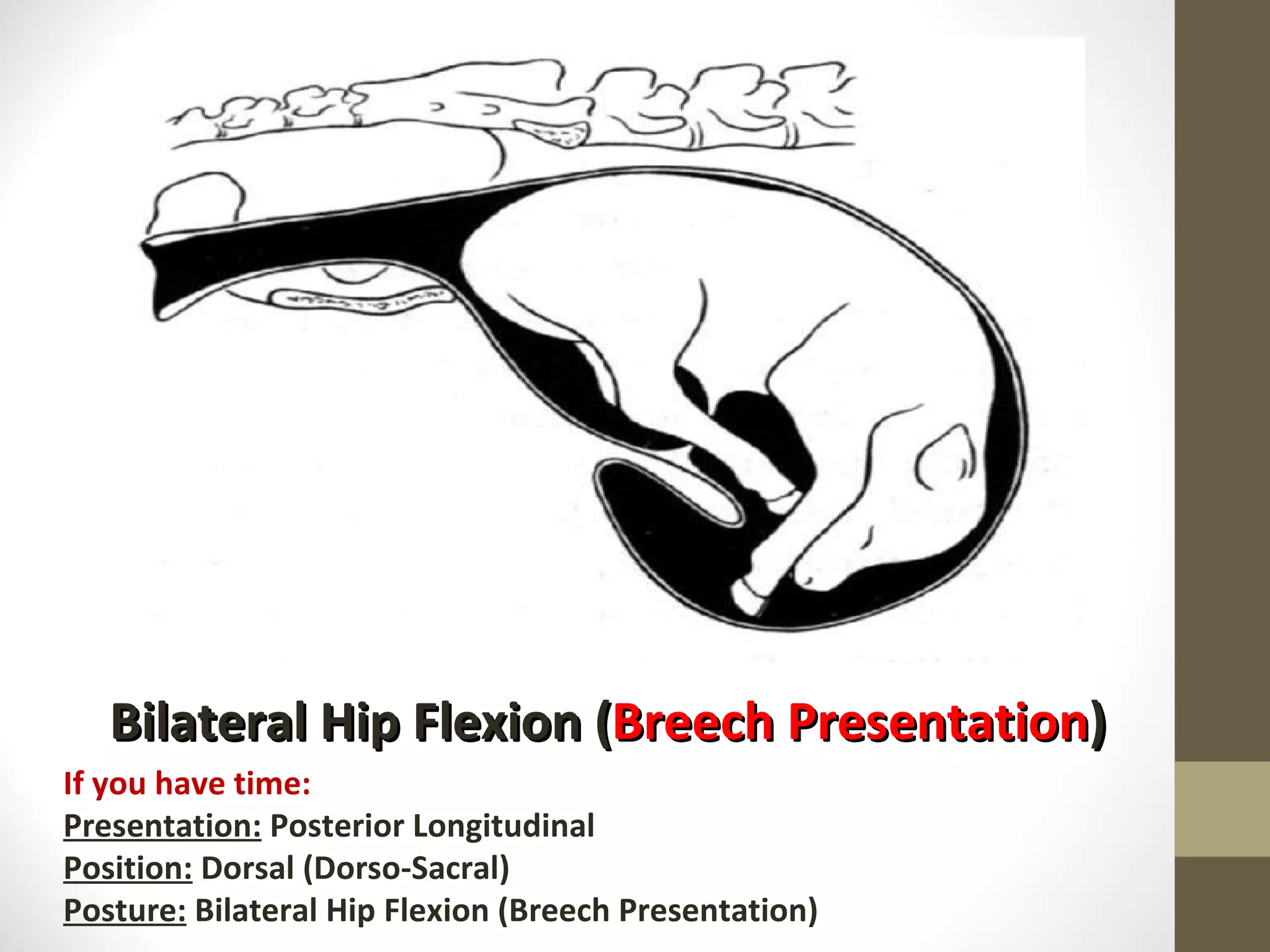 5th year practical revision fetal presentations | PPT