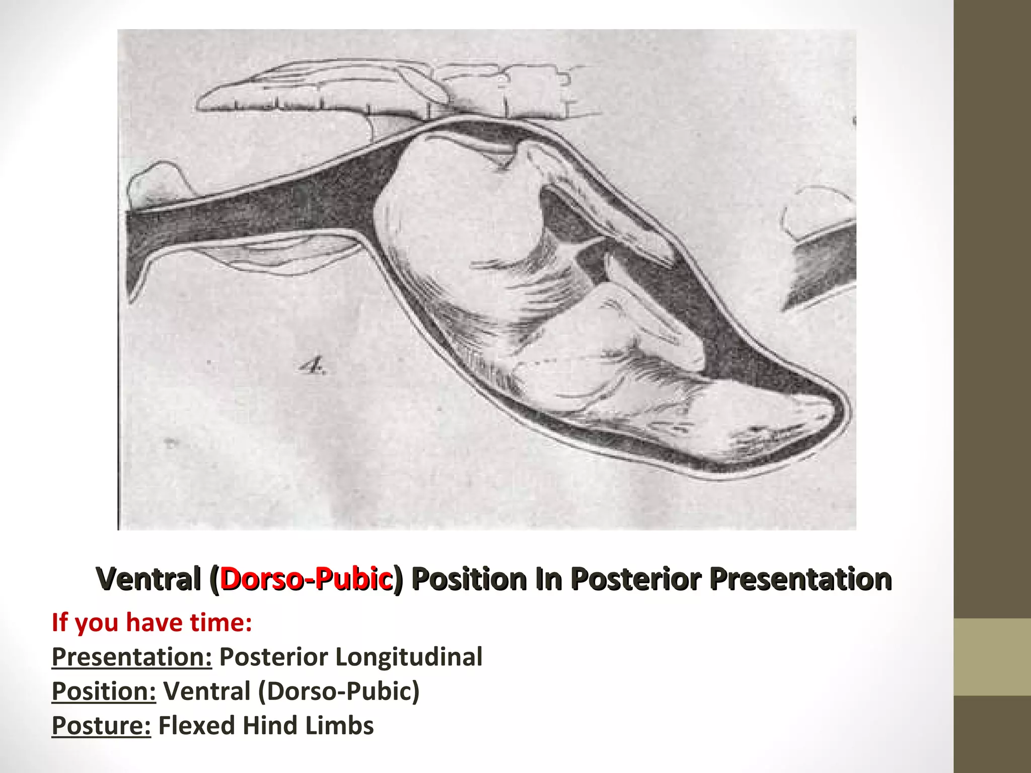 5th year practical revision fetal presentations | PPT